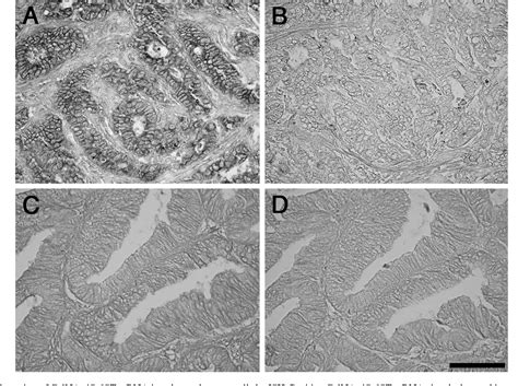 Figure 3 From The Utility Of Formalin Fixed And Paraffin Embedded