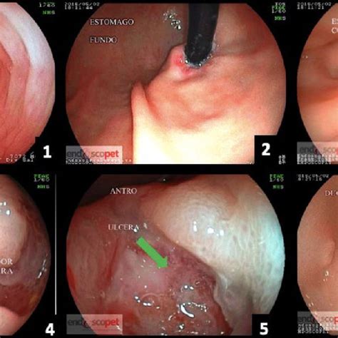 A Esophagus B Stomach Fundus C Stomach Body D Stomach
