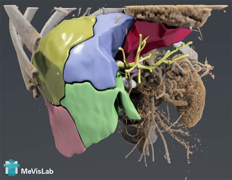 Mevis Path Tracer — Mevislab Documentation
