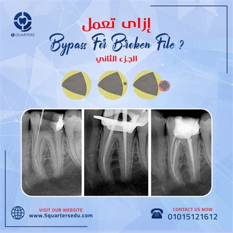 ازاي تعمل Bypass For Broken File ؟ الجزء التاني