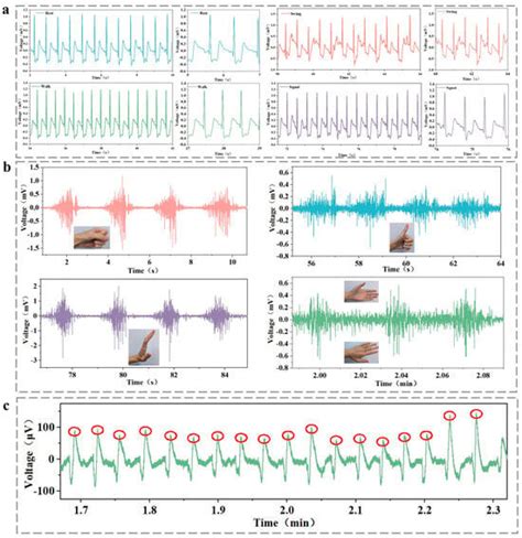 Biosensors An Open Access Journal From Mdpi