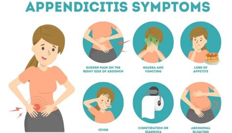 Apendicitis Apéndice Inflamado Diagnóstico De Problemas 52 Off