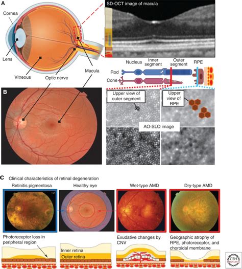 Ipsc Rpe In Retinal Degeneration Recent Advancements And Future