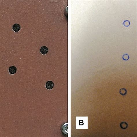 Laparoscopic Views Of A Task 1 And B Task 2 Download Scientific Diagram