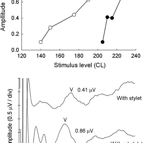 Electrically Evoked Auditory Brainstem Response Input Output Functions Download Scientific