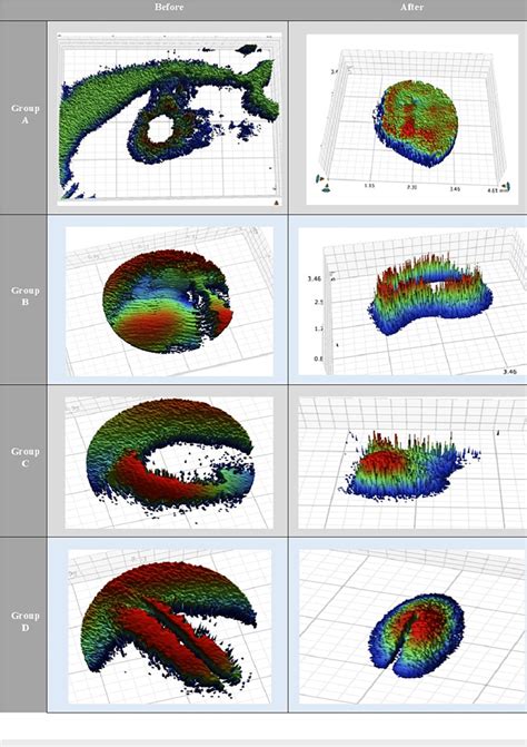 Surface Roughness Before And After Different Bleaching Treatments Using Download Scientific