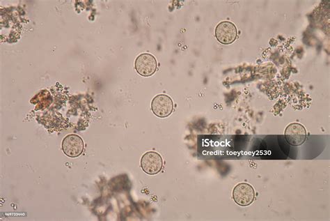 Entamoeba Histolytica Adalah Protozoa Parasit Anaerobik Bagian Foto