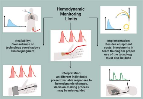 Monitor Smart Use Better The Future Of Haemodynamic Monitoring