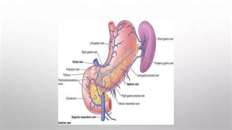 Subtotal Gastrectomy With Gastrojejunostomy Pptx