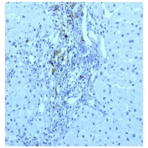 Representative Microphotographs Of Cd20 Marker By Immunohistochemistry Download Scientific