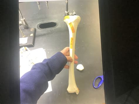 Tibia Diagram Quizlet