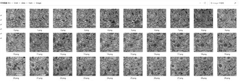 计算机视觉语义分割——u Netconvolutional Networks For Biomedical Image Segmentation Csdn博客