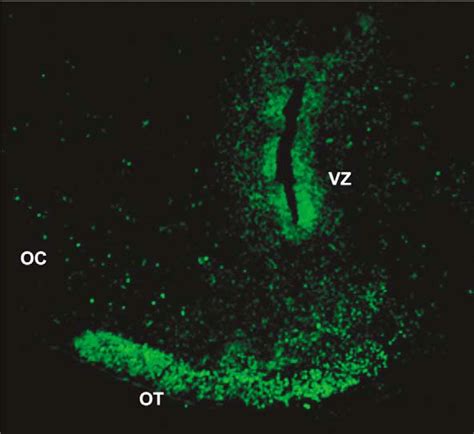 Sagittal Brain Section From A Wild Type Mouse At Postnatal Day Zero Download Scientific