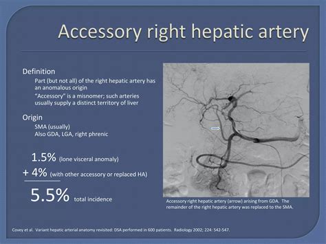 Hepatic Arterial Anatomy And Vascular Optimization Final Pptx