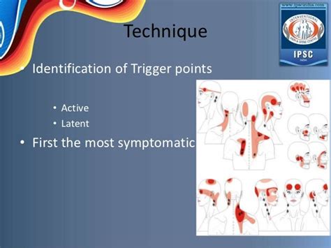 Trigger Point Injection