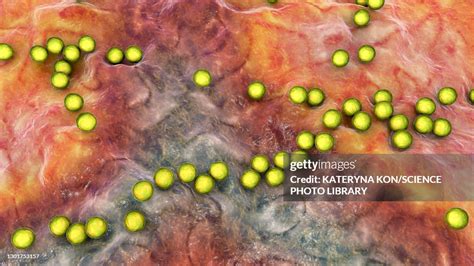 Streptococcus Pyogenes Bacteria Illustration High Res Vector Graphic