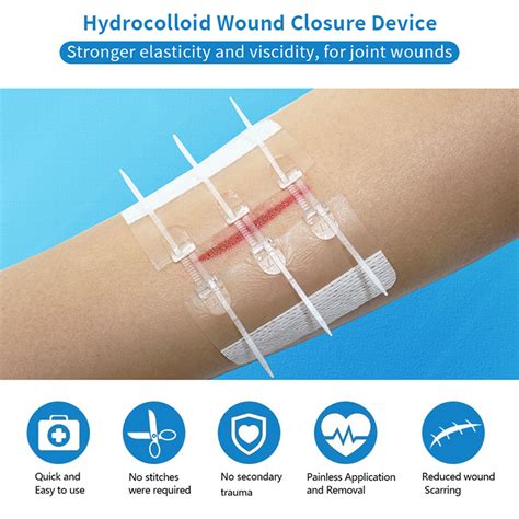 Elastic Hydrocolloid Wound Closure Devicewound Closure Device