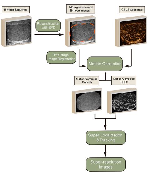 Figure 1 From Non Invasive Ultrasound Localization Microscopy Ulm In