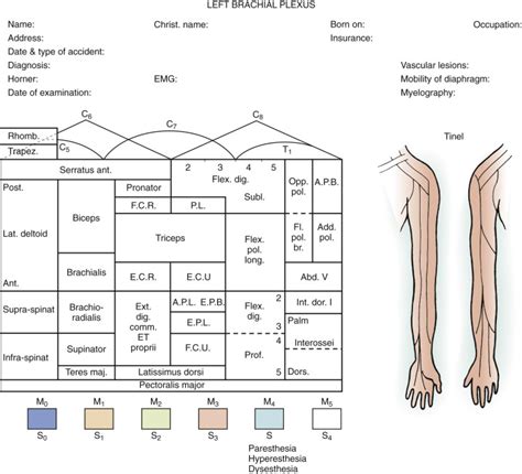 Mallet Classification Brachial Plexus At Jorge Damon Blog