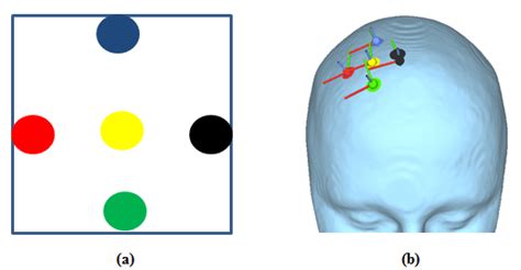 Placement Of 4⇥1 Hd Tdcs Electrode Configurations Instead Of