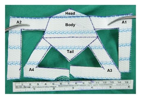 Components Of The Anterior Transvaginal Tailored Mesh Surgical