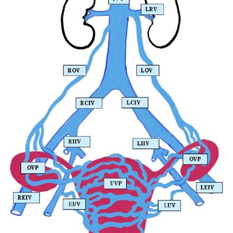 Normal Pelvic And Ovarian Venous Anatomy The Rich Uterine Venous