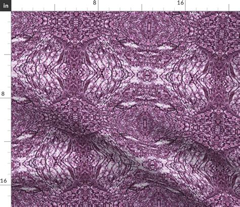 Reticular Tissue Under Microscope