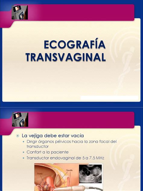 Ultrasonido Transvaginal Pdf Ultrasonido Médico Ultrasonido