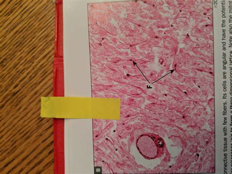 Histo Exam 2 Flashcards Quizlet