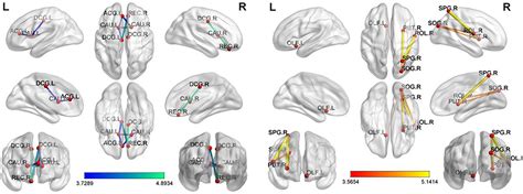 Abnormal Topological Organization Of Human Brain Connectome In Primary Jpr