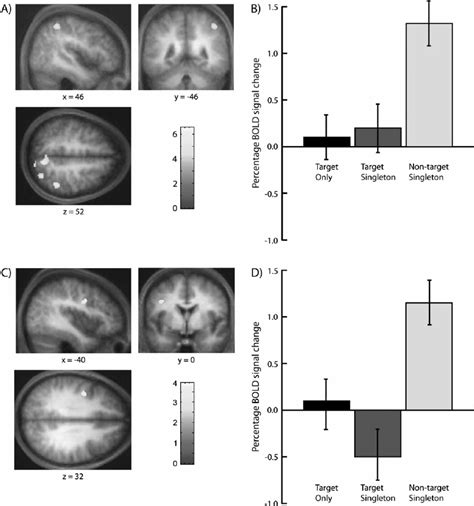 Cortical Areas Specific For Auditory Attentional Capture Shown In The Download Scientific
