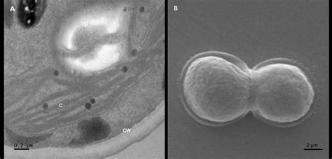 Demonstration Of The Antioxidant Potential Of Three Newly Isolated Carotenoid Producing
