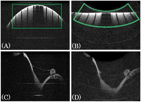 Image Correction Optical Coherence Tomography Oct Crosssectional Download Scientific Diagram