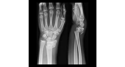 10 Methods To Use Picture To Textual Content Llms Codesanitize