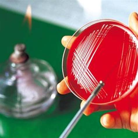 How To Spore Test An Autoclave Sciencing