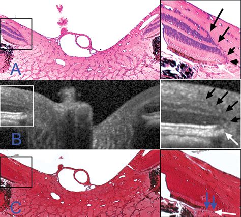 Identification Of The Neural Canal Opening Right Magnification Of Download Scientific Diagram