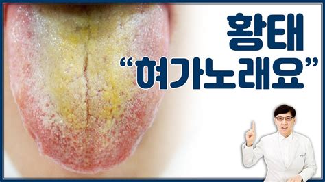 혓바닥이 노란색이에요혀가 노래요 Youtube