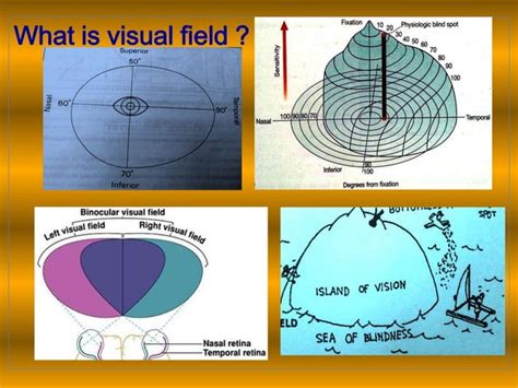 Visual Field Analysis Interpretation Pptx Eye And Vision Conditions Diseases And Conditions