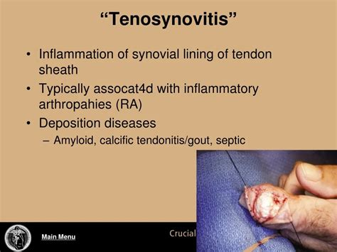 Ppt Tendinopathies In Hand Terminology Pathology And Treatments
