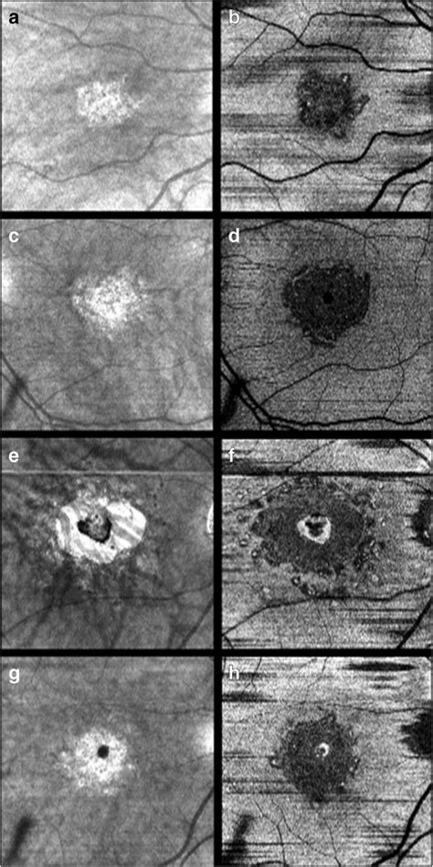 A B C D E F G H Comparison Of The Sub Rpe Slab A C E G Download Scientific