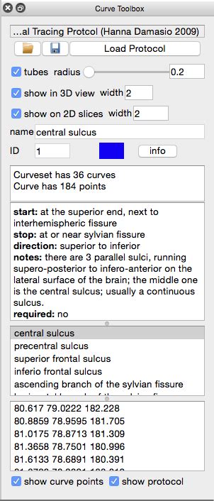 Sulcal Curve Delineation · Brainsuite
