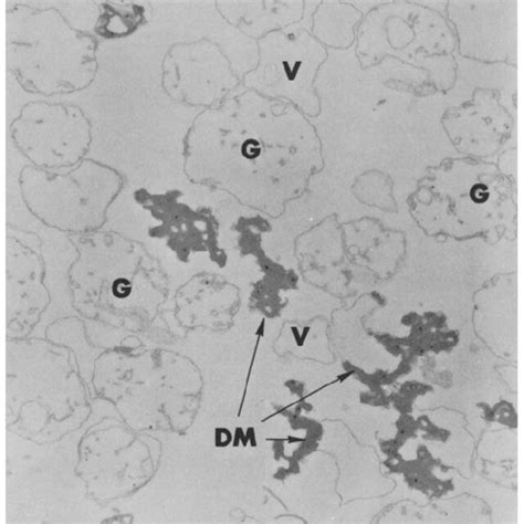 Electron Micrograph Of Water Suspended Mitochondria Fixed In