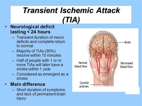 Transient Ischemic Attack How To Prevent Transient Ischemic Attacks