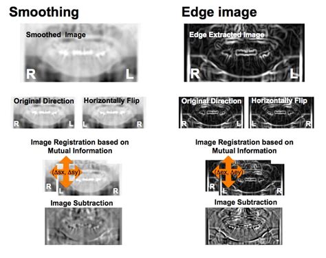 Example Of A Filtered Image And Determination Of Subtraction Results Download Scientific