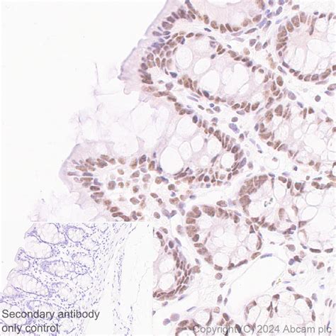 Anti Cdk12 Antibody [epr29009 30] Ab317746 Abcam