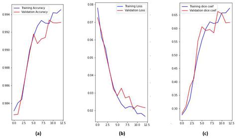 Brain Tumor Detection And Classification Using Deep Learning And Sine Cosine Fitness Grey Wolf