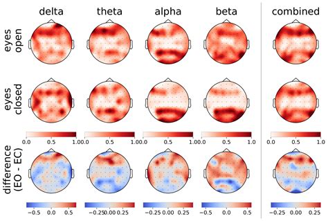 Github Philippthoelkeeeg Transformer Analysis Of Transformer Attention In Eeg Signal
