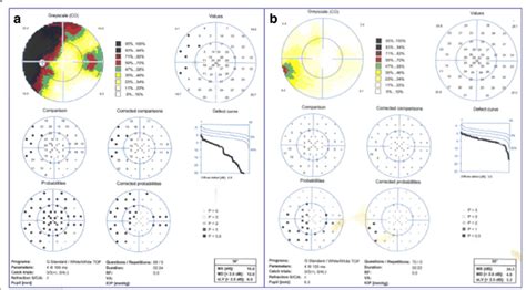 Octopus Visual Field Analyser Visual Field Analyzer Green Medical Co LTD Used Medical