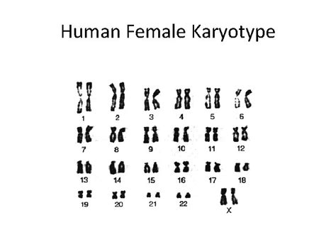 Chromosomes And Meiosis Somatic Cells Also Called Body