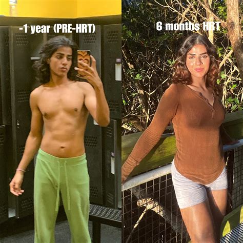 Mtf 19 1 Year Pre Hrt Vs 6 Months Hrt Rtranstimelines